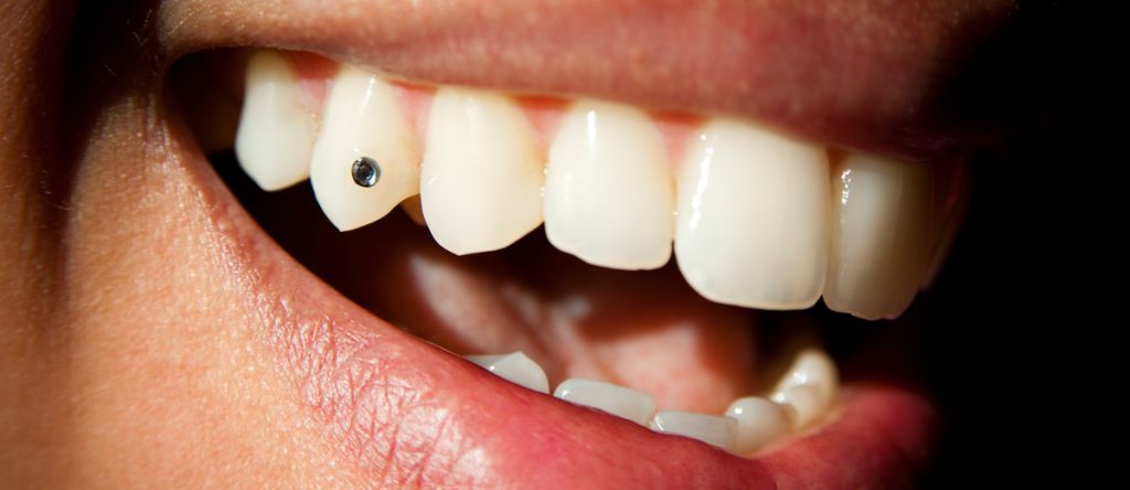 Back to the 90s: Zahnsteinchen sind wieder da